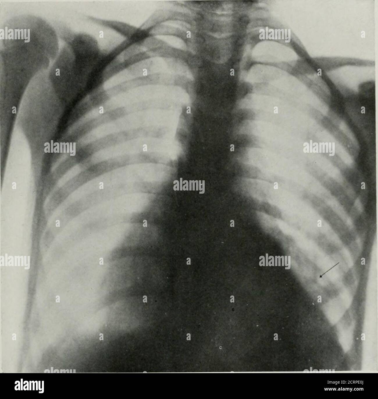 W c roentgen hi-res stock photography and images - Alamy