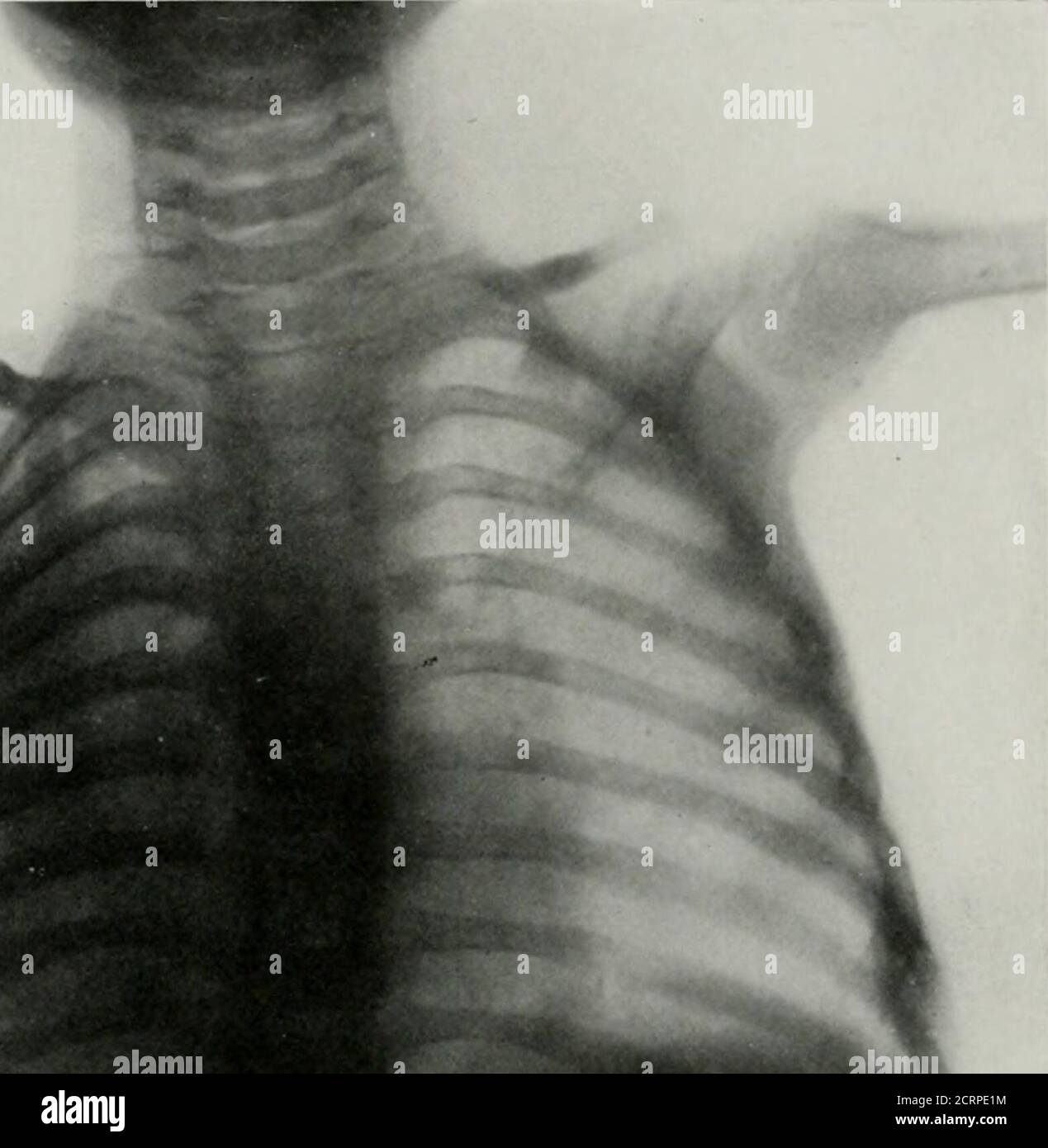 . Living anatomy and pathology; the diagnosis of diseases in early life ...