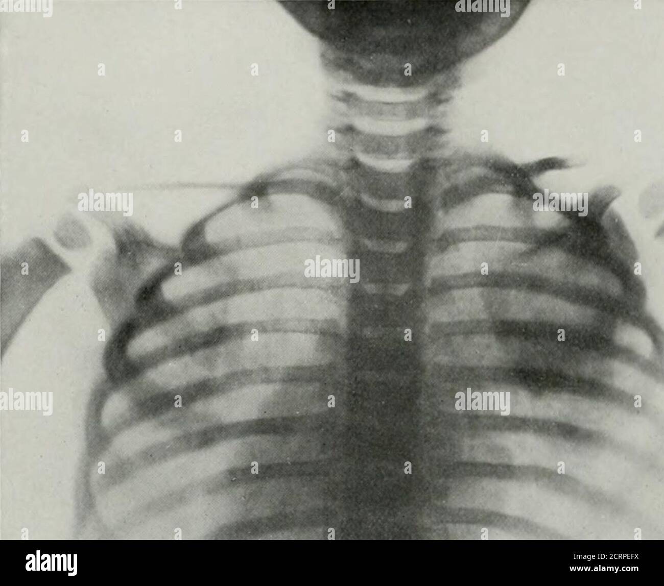 . Living anatomy and pathology; the diagnosis of diseases in early life ...