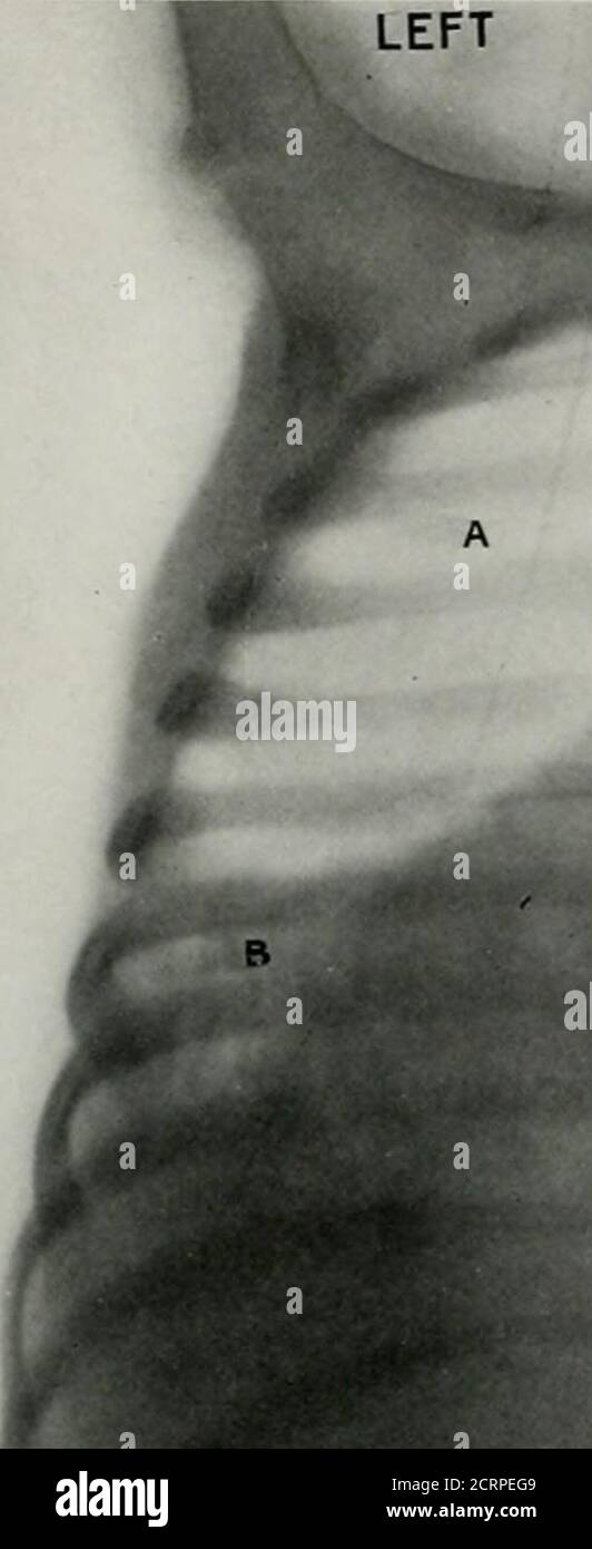 . Living anatomy and pathology; the diagnosis of diseases in early life ...