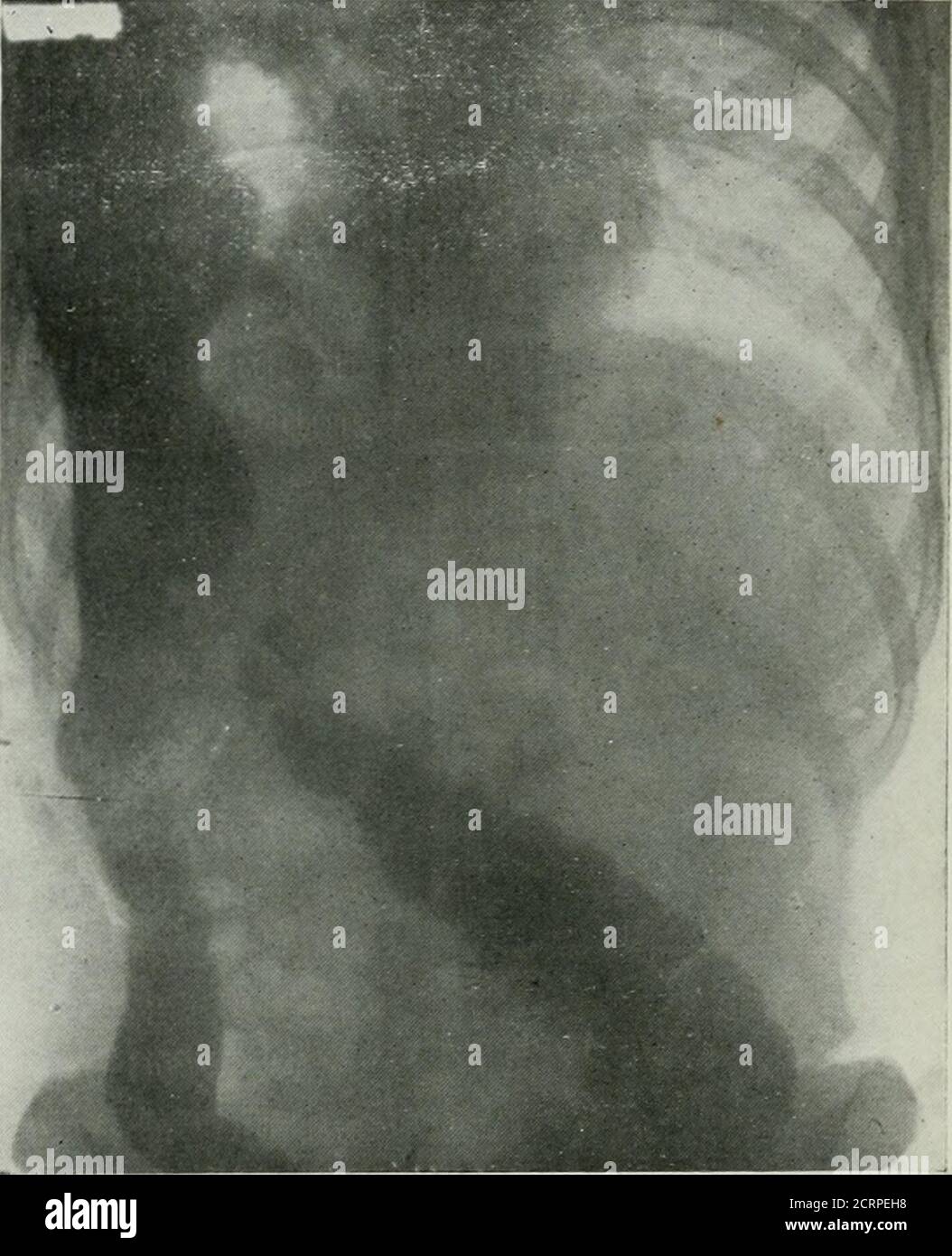 . The American journal of roentgenology, radium therapy and nuclear ...
