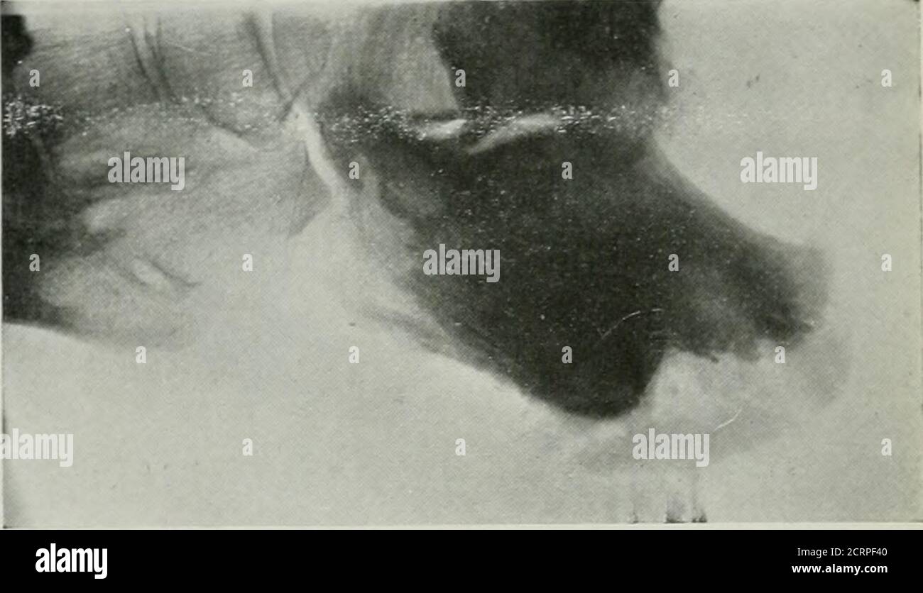 . The American journal of roentgenology, radium therapy and nuclear ...