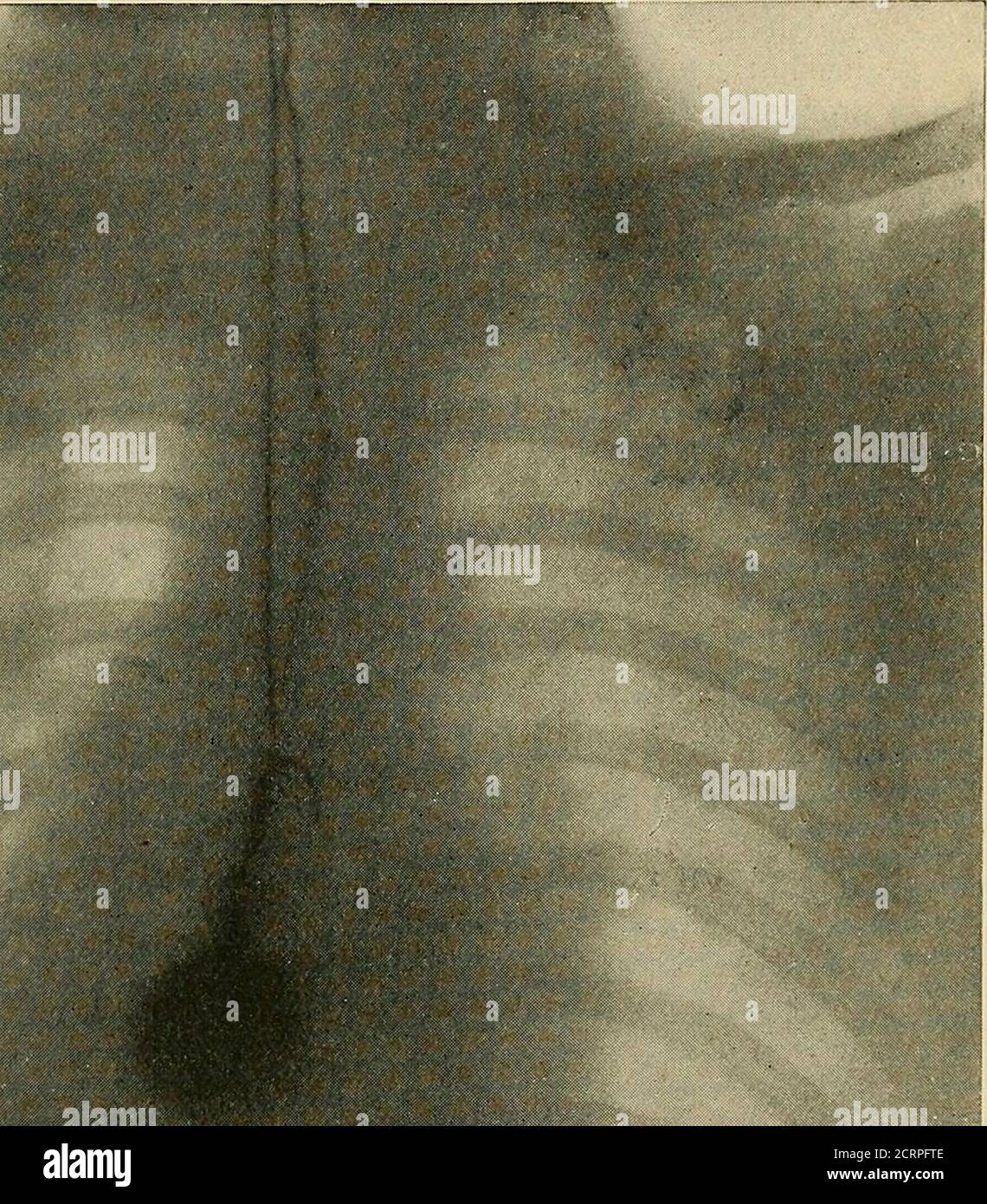X rays for different bodies hi-res stock photography and images - Alamy
