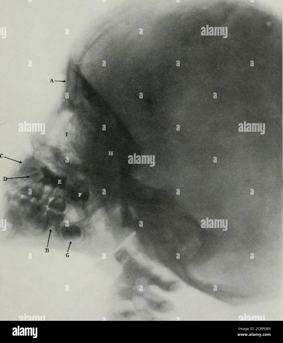. Living anatomy and pathology; the diagnosis of diseases in early life ...