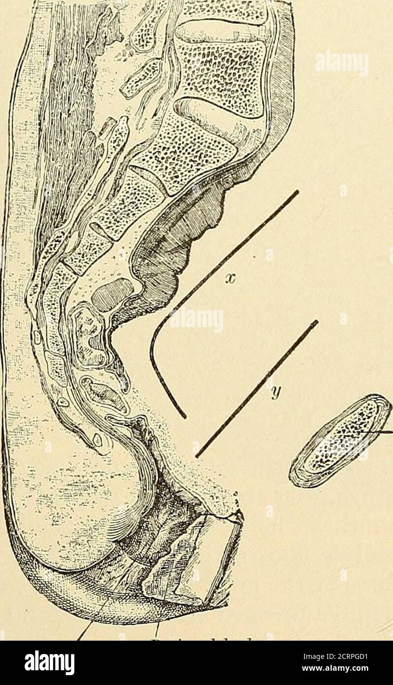 . A treatise on obstetrics for students and practitioners . When ...