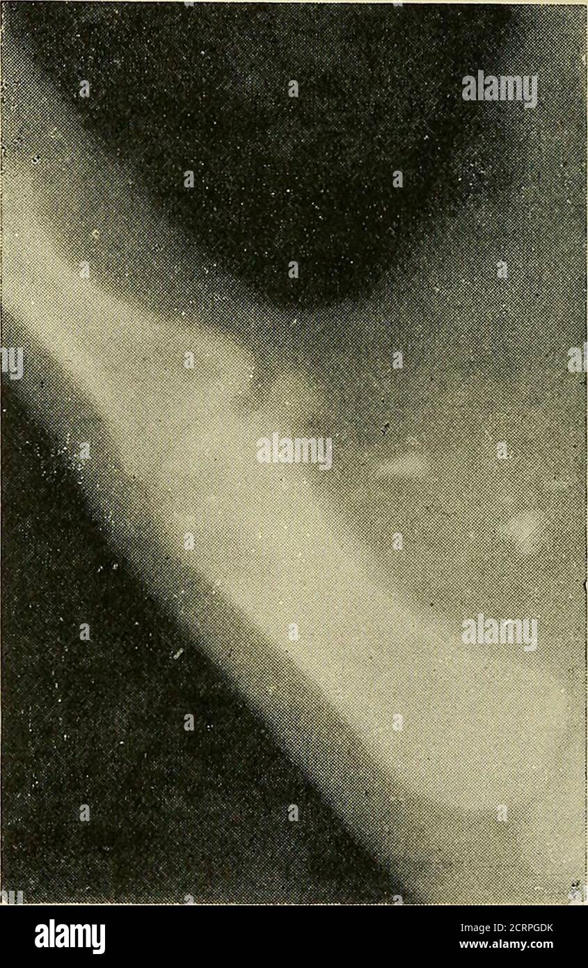 Laceration large hi-res stock photography and images - Alamy