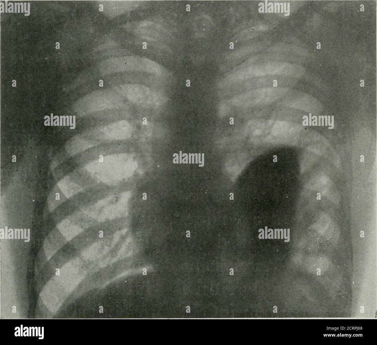 . The American journal of roentgenology, radium therapy and nuclear ...