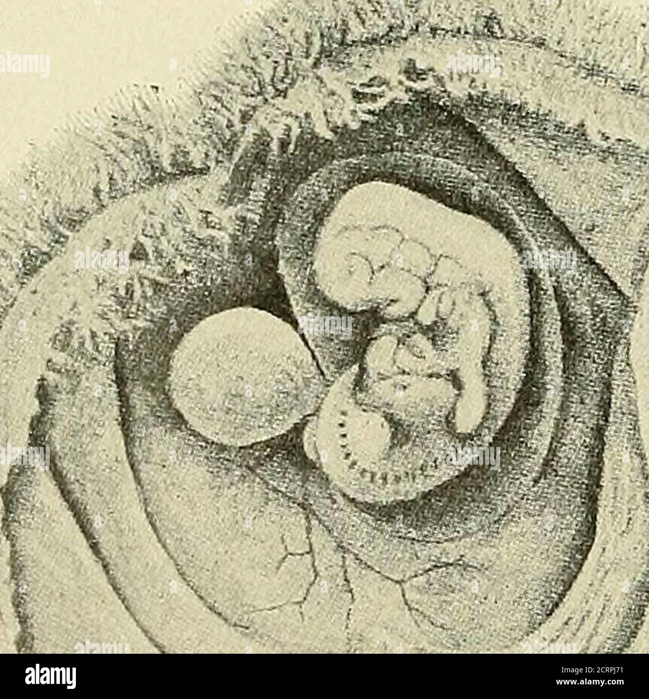 Yolk sac membrane hi-res stock photography and images - Alamy