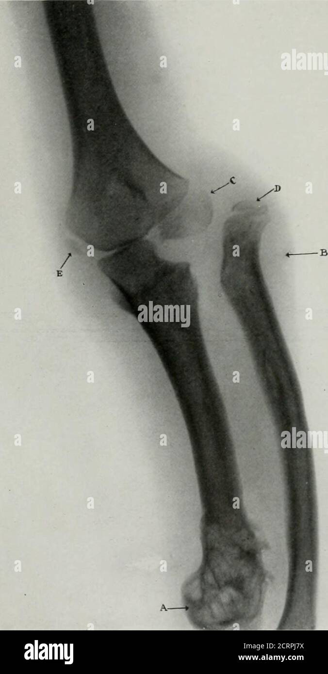. Living anatomy and pathology; the diagnosis of diseases in early life ...