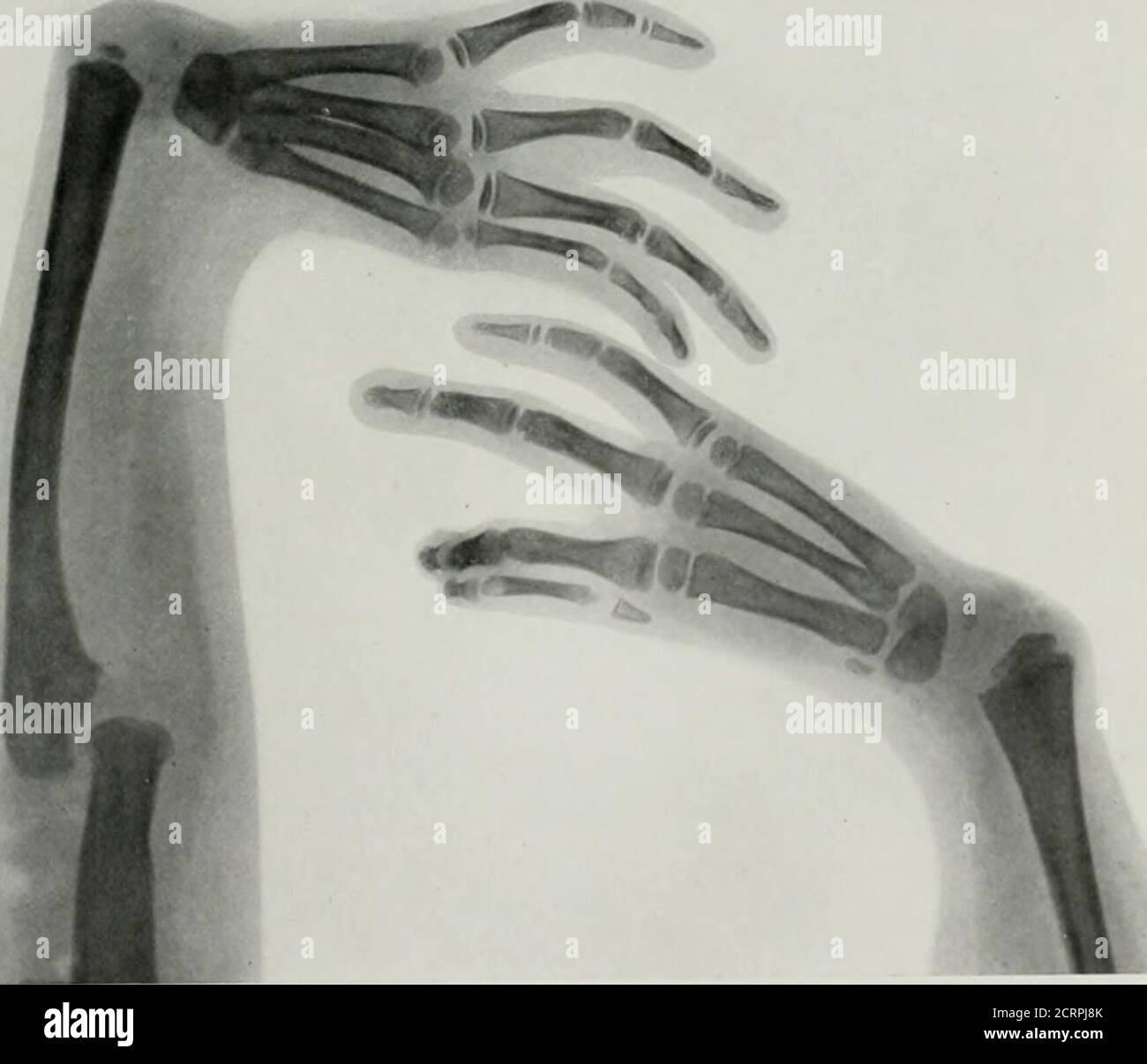 . Living anatomy and pathology; the diagnosis of diseases in early life ...