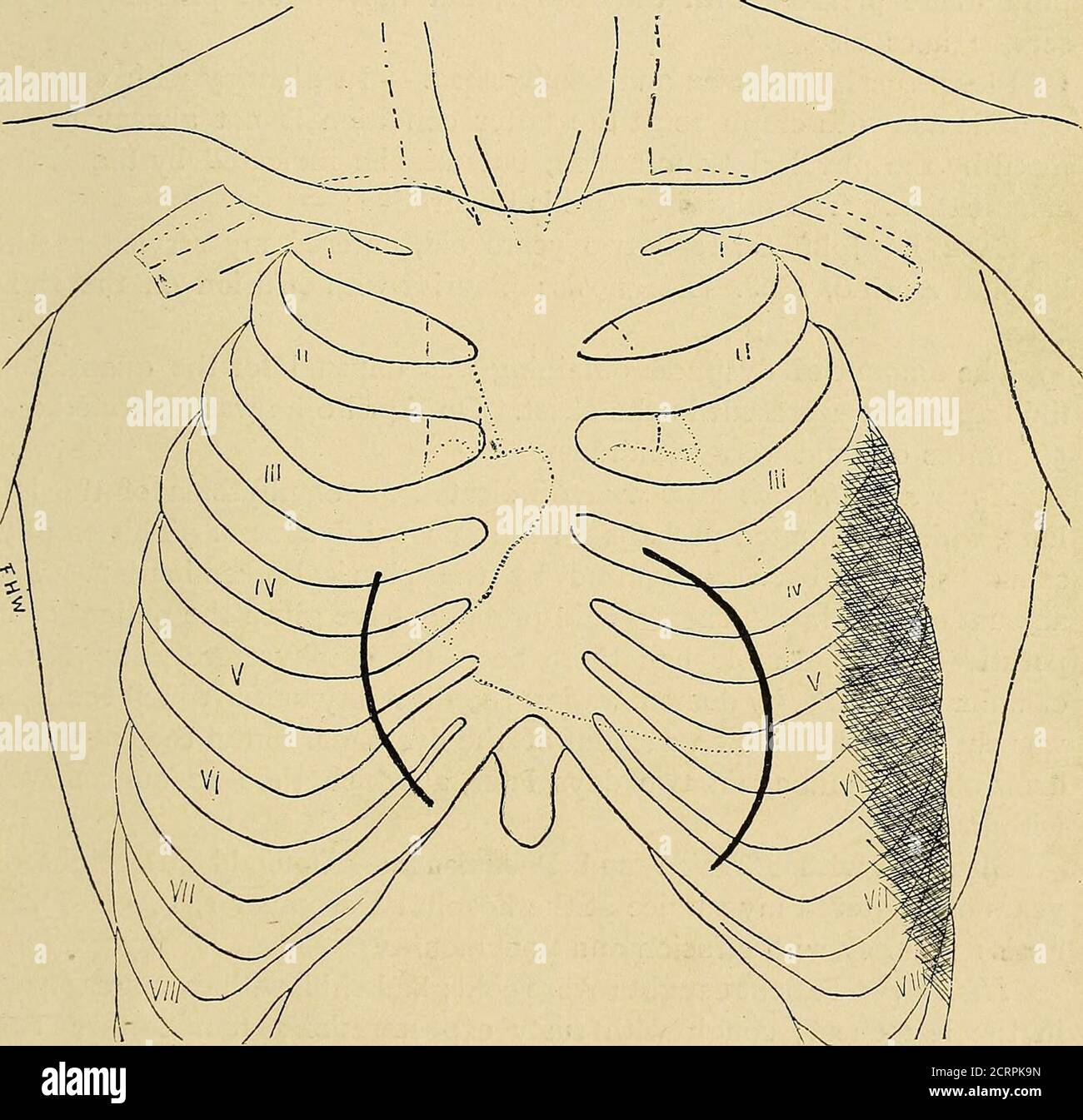X rayexamination hi-res stock photography and images - Alamy