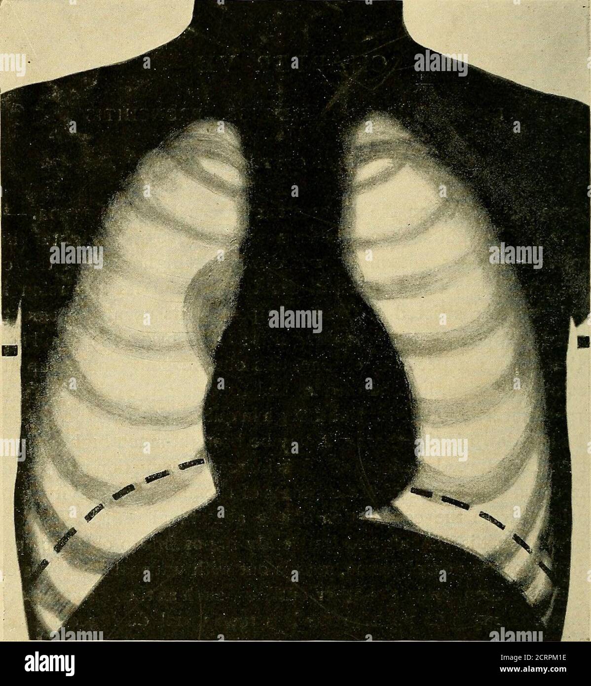Agent axis hi-res stock photography and images - Alamy