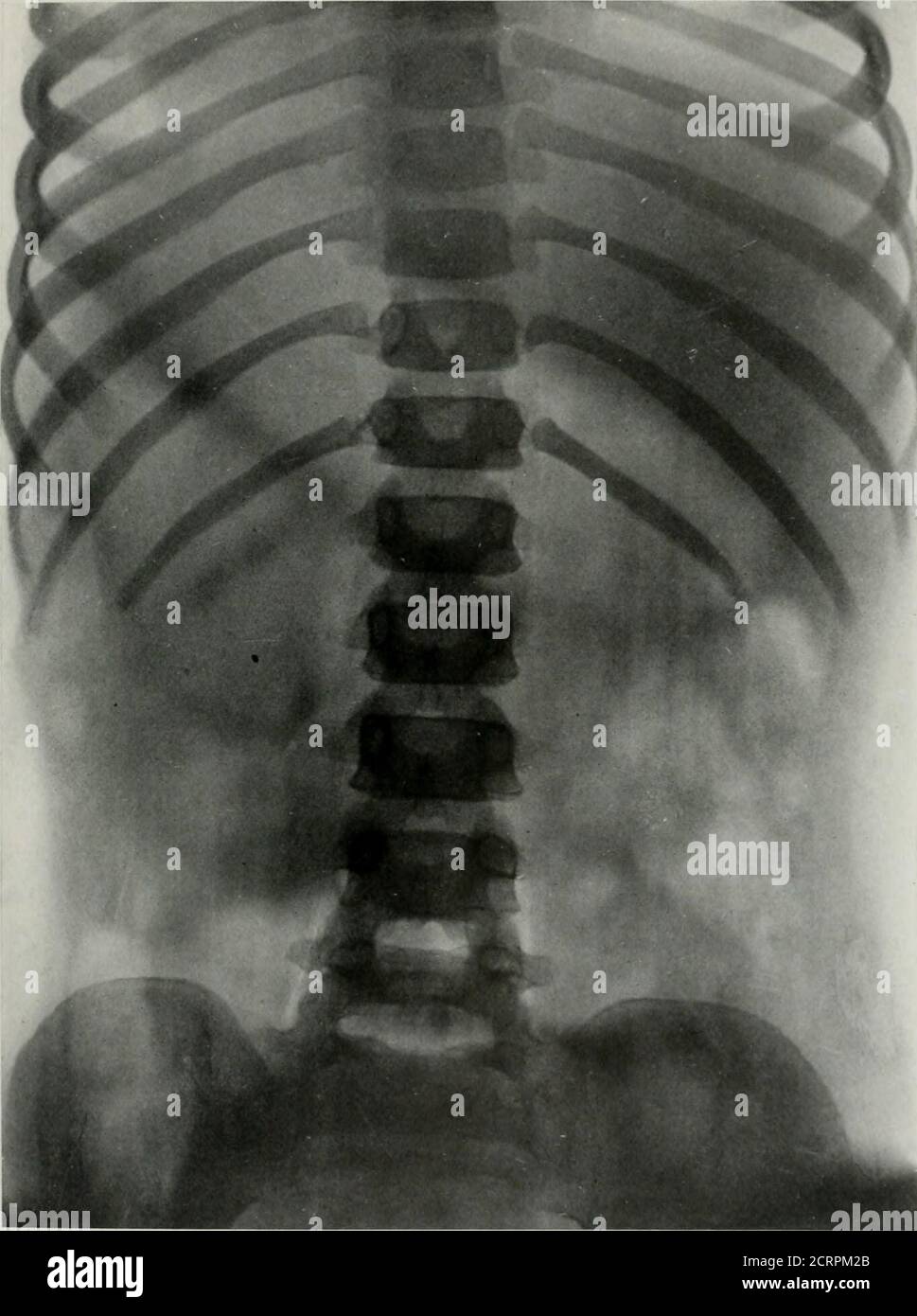 . Living anatomy and pathology; the diagnosis of diseases in early life ...