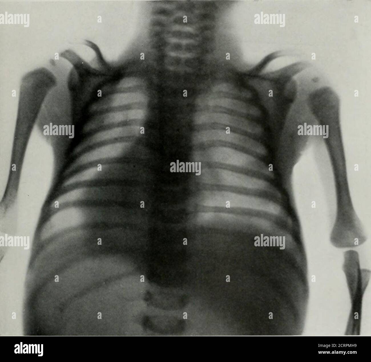 . Living anatomy and pathology; the diagnosis of diseases in early life ...