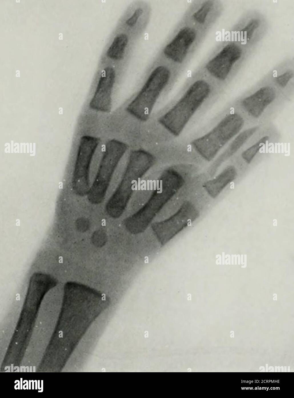 . Living anatomy and pathology; the diagnosis of diseases in early life ...