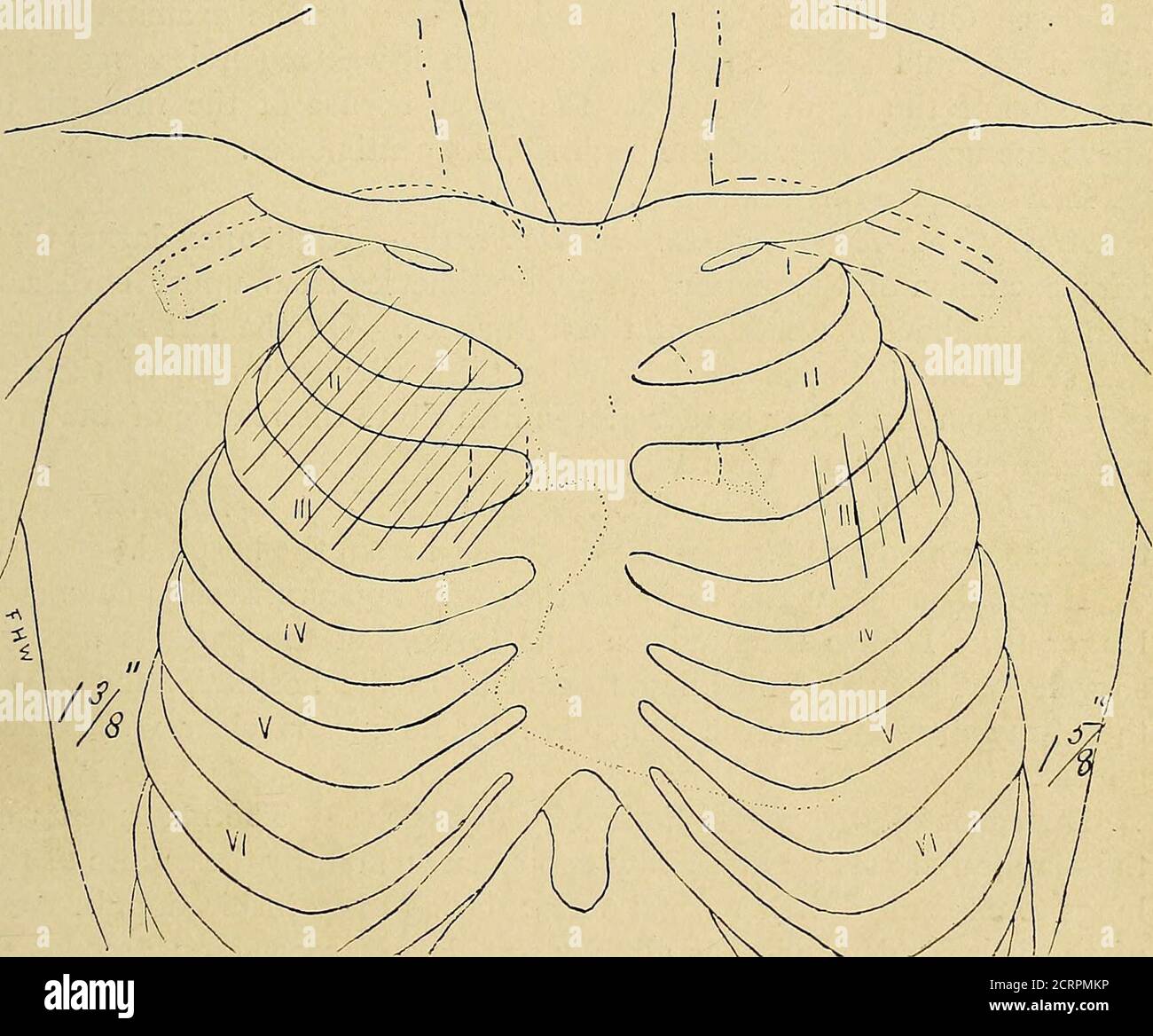 . The Roentgen rays in medicine and surgery as an aid in diagnosis and ...