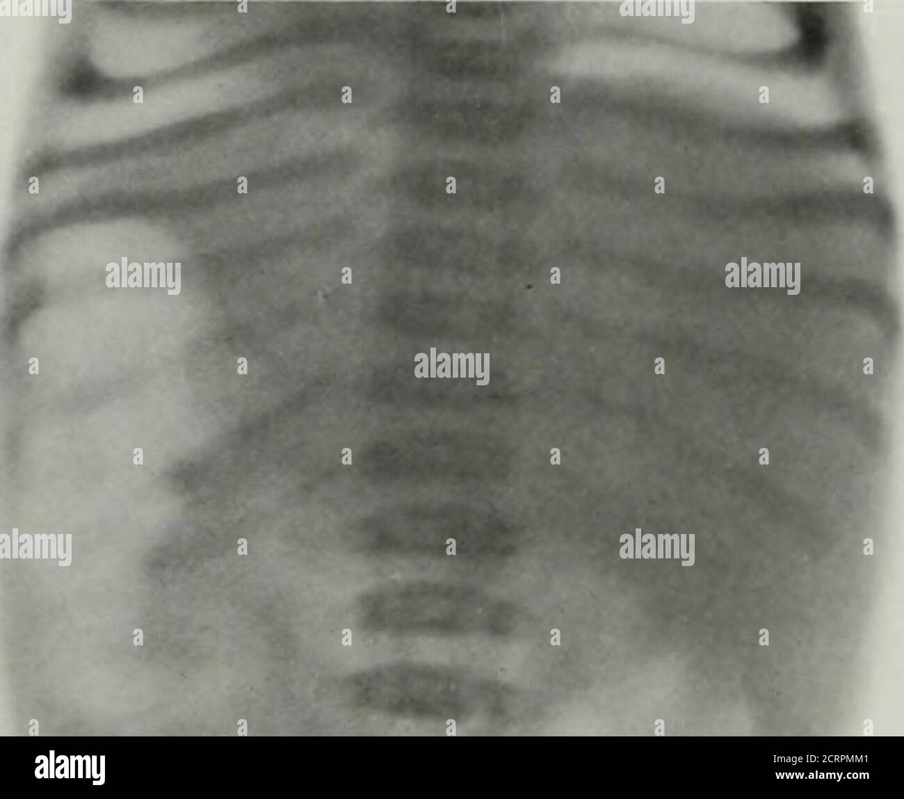 . Living anatomy and pathology; the diagnosis of diseases in early life ...