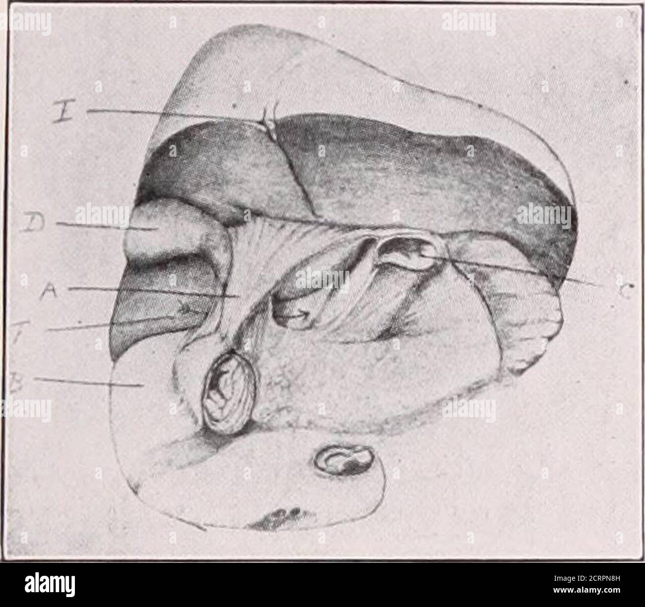 . Journal of roentgenology . Plate No. 2. Modification of Original ...