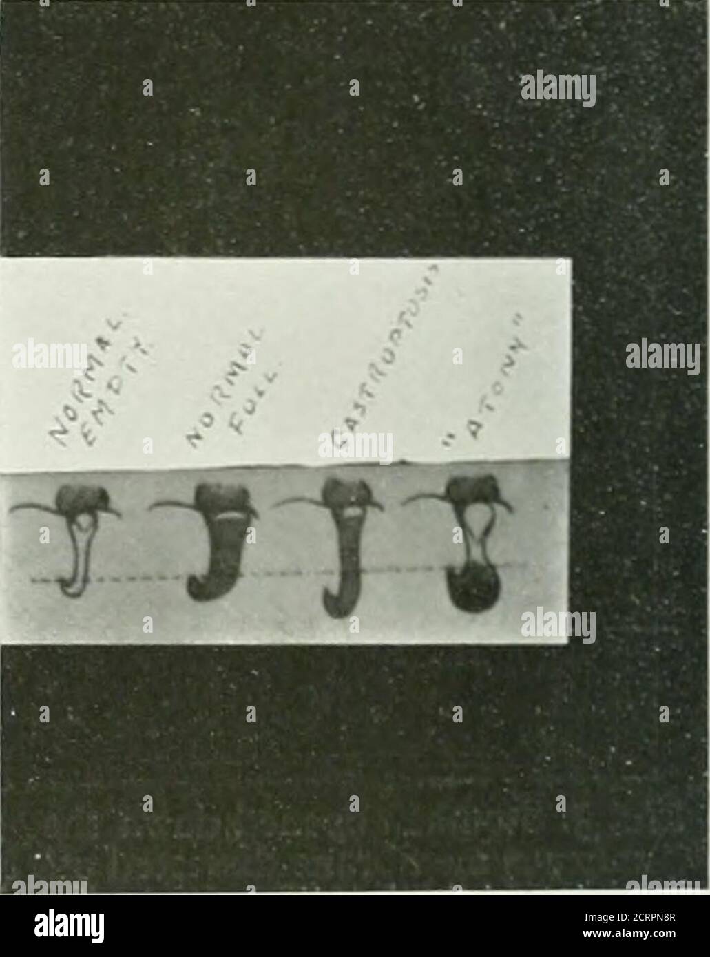 . The American journal of roentgenology, radium therapy and nuclear ...
