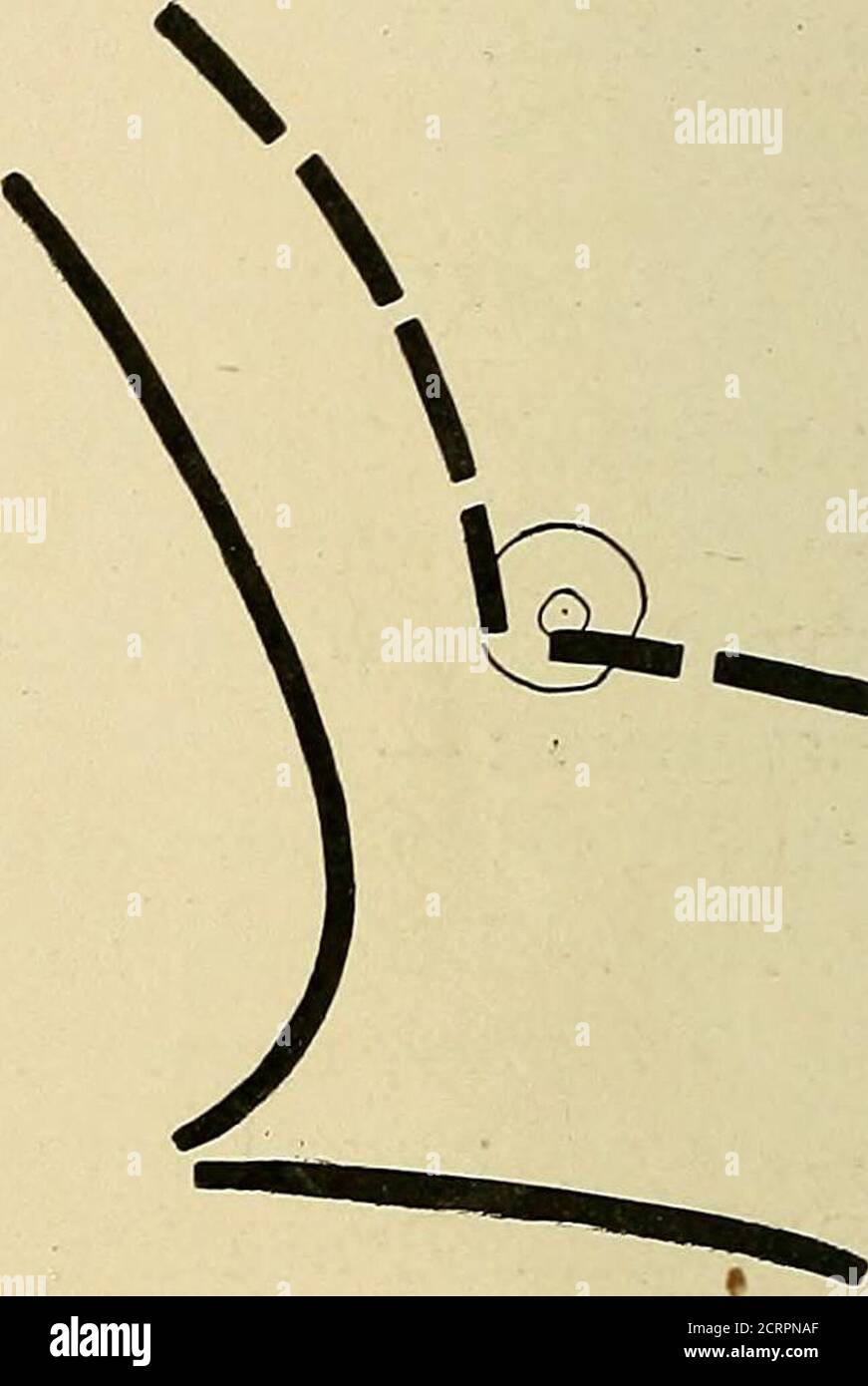. The Roentgen rays in medicine and surgery as an aid in diagnosis and ...