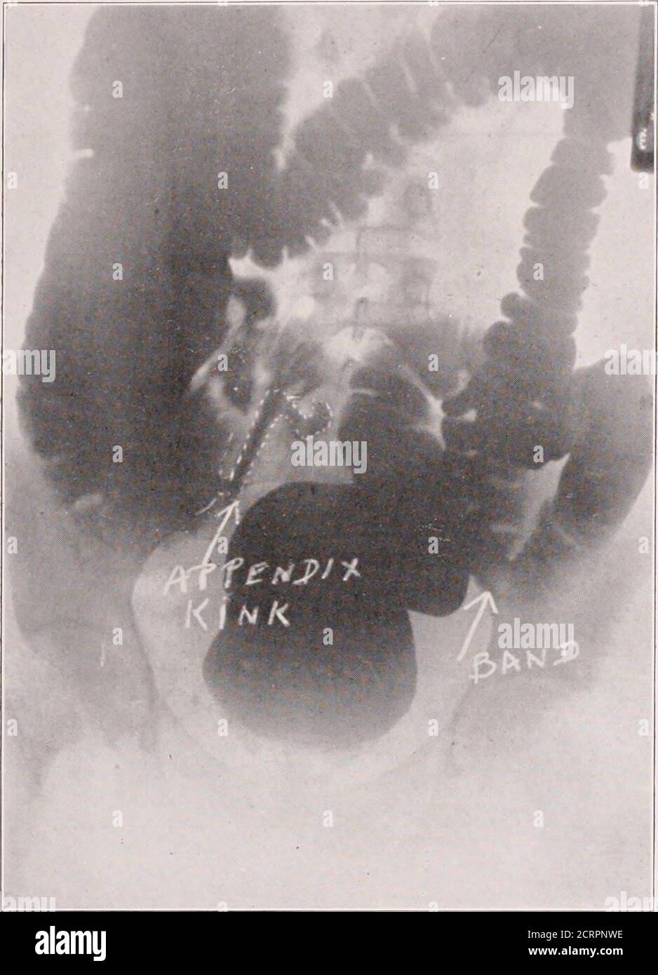 . Journal of roentgenology . Figure 6 four hundred eleven abnormalities ...