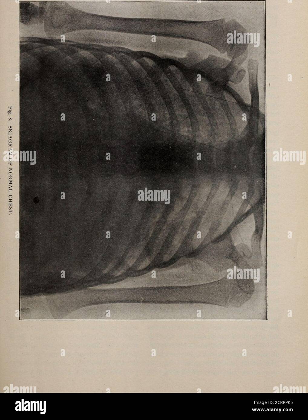 Cadaver study hi-res stock photography and images - Alamy