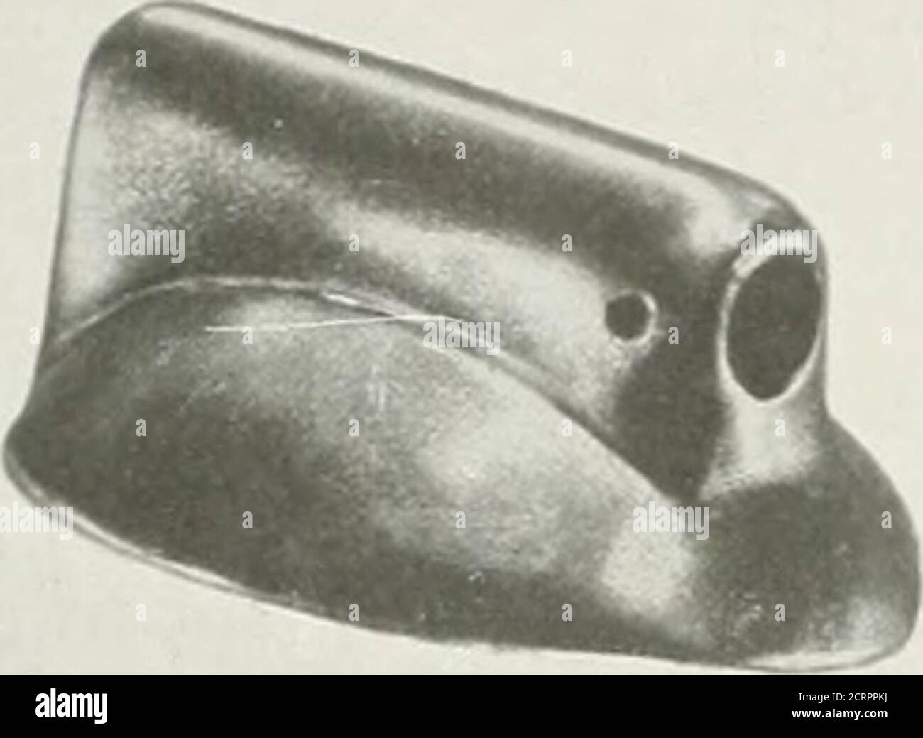 Nuclear cataracts hi-res stock photography and images - Alamy