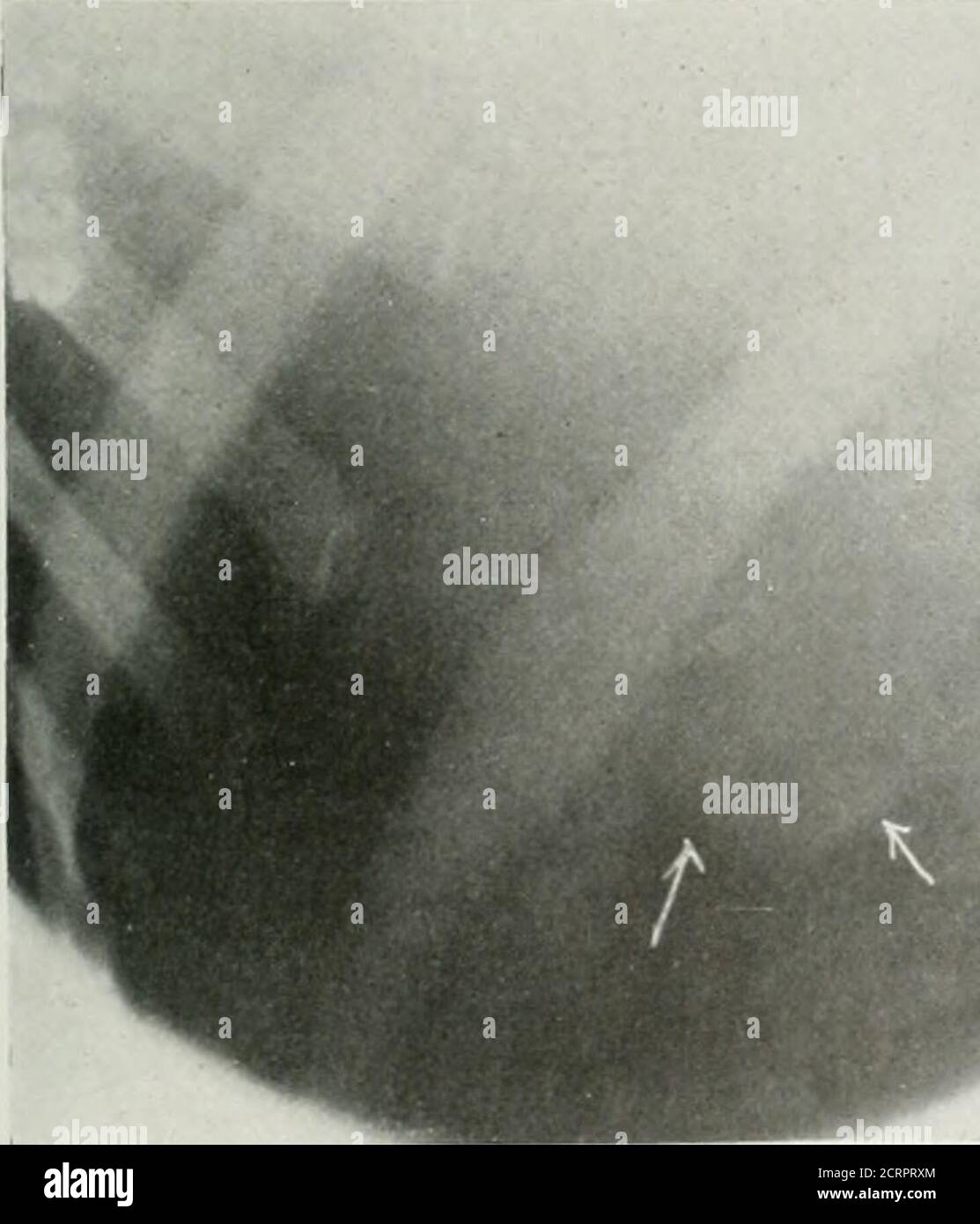 . The American journal of roentgenology, radium therapy and nuclear ...