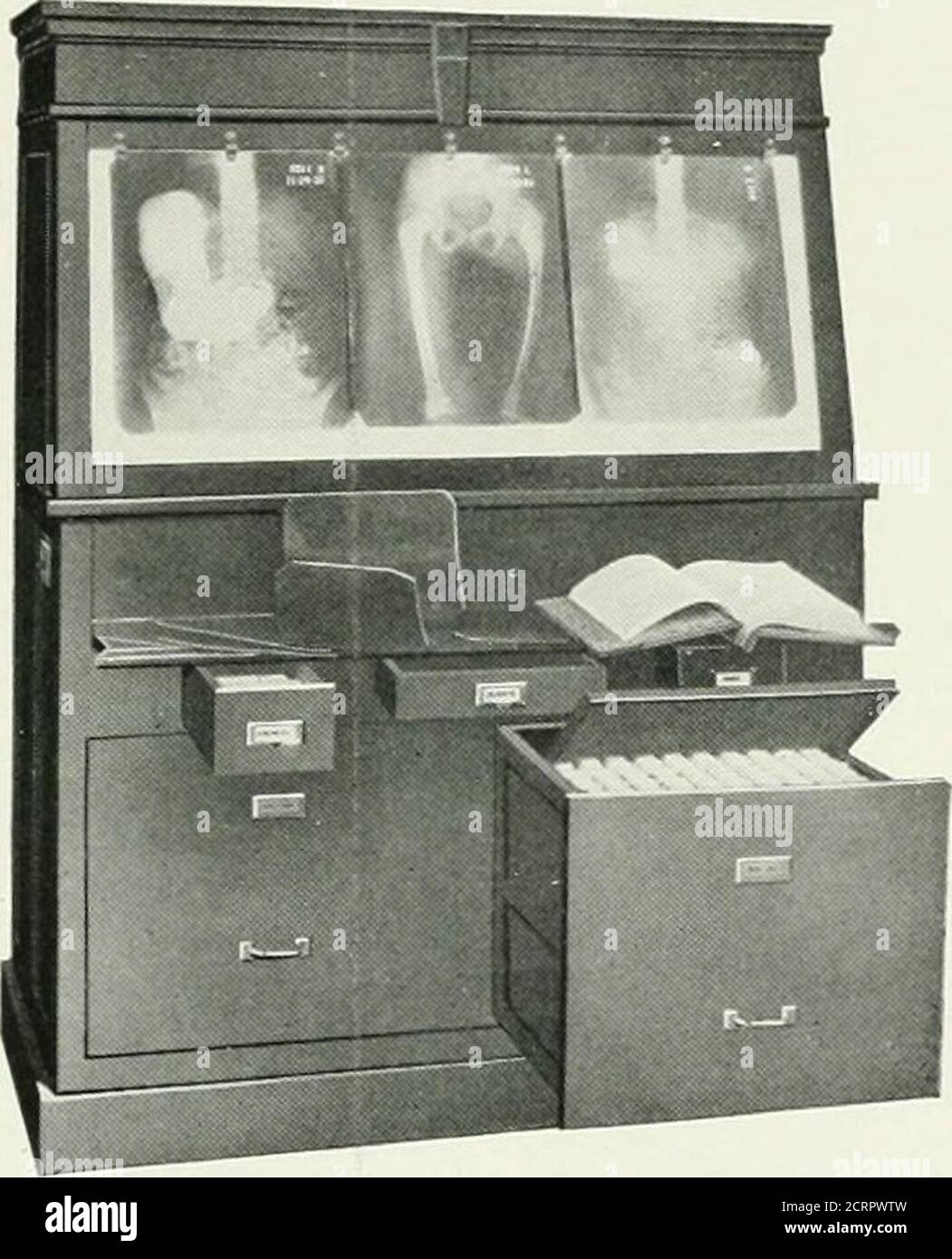 Gamma rays medicine hi-res stock photography and images - Alamy