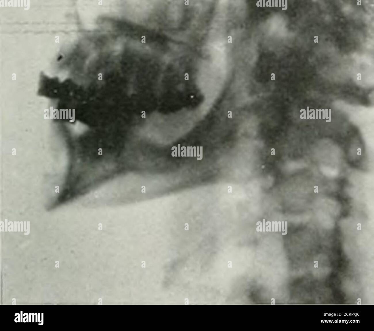 . The American journal of roentgenology, radium therapy and nuclear ...