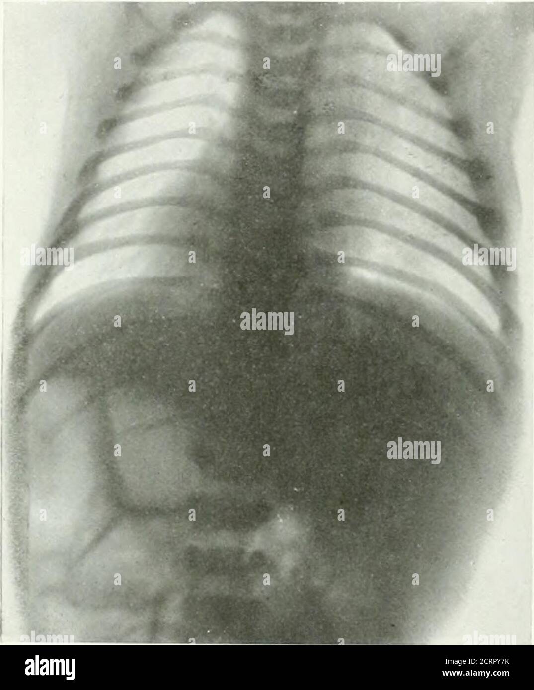 . The American journal of roentgenology, radium therapy and nuclear ...