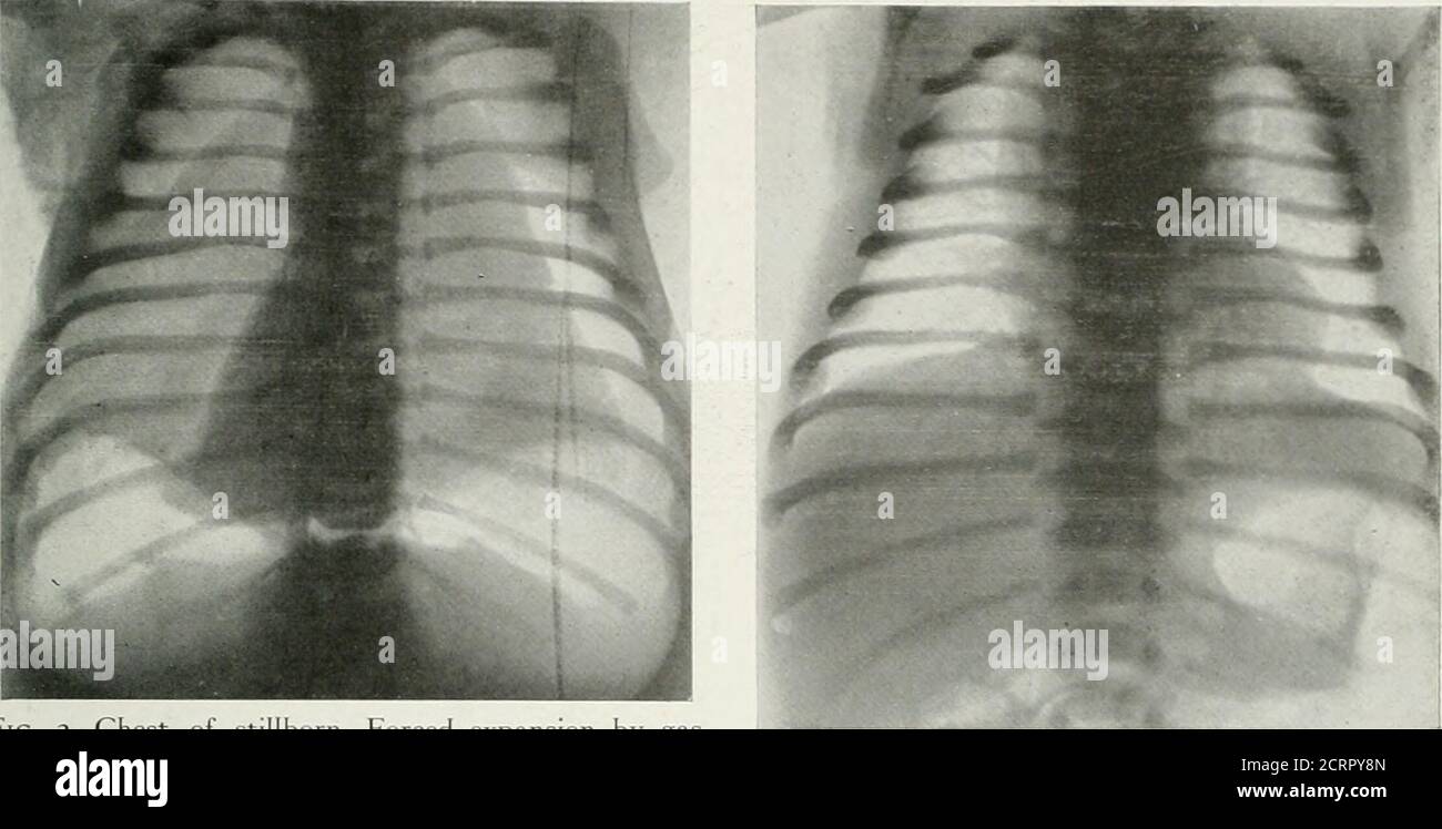 . The American journal of roentgenology, radium therapy and nuclear ...