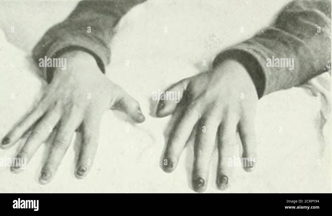 Radium upon hi-res stock photography and images - Alamy