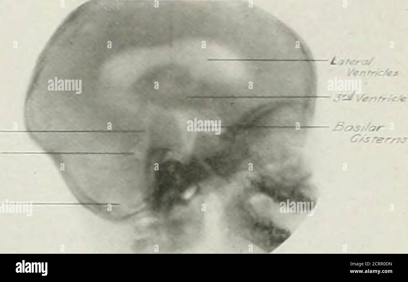 Max brodel hi-res stock photography and images - Alamy