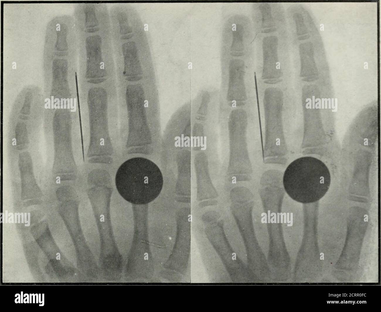 Coin radiography hi-res stock photography and images - Alamy