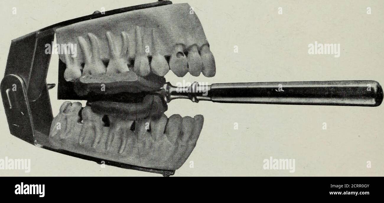 . Elementary and dental radiography . Fig. 331. Mollified Kny-Slieerer ...