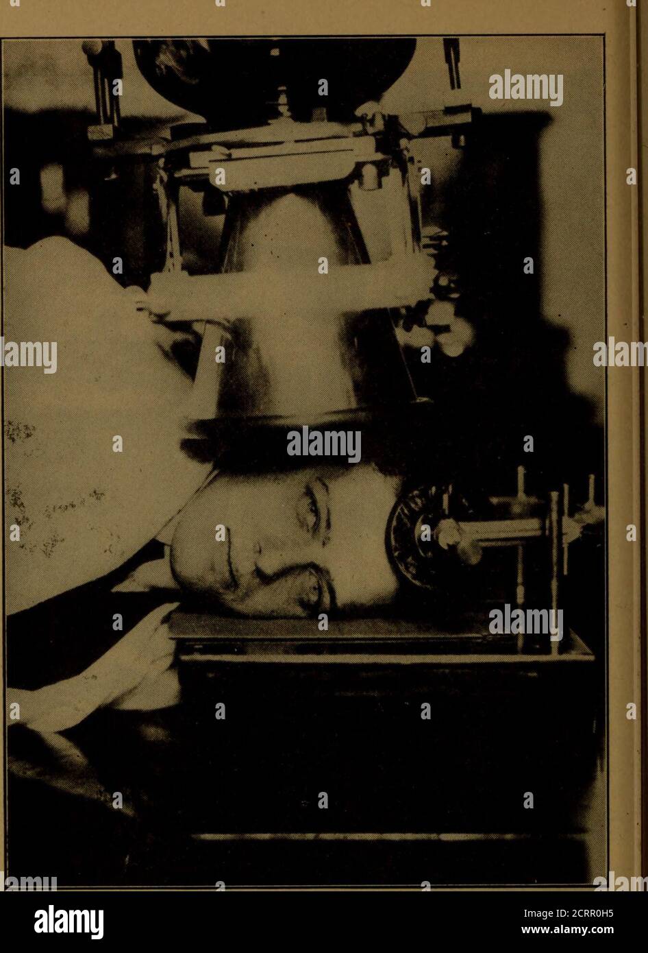 . X-ray manual : U.S. Army . Fig. 9. Adjustment for exposure of ...
