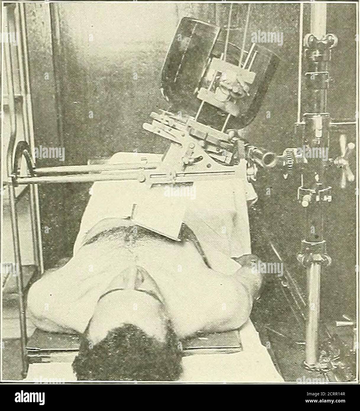 . The principles and practice of roentgenological technique . Fig. 23 ...