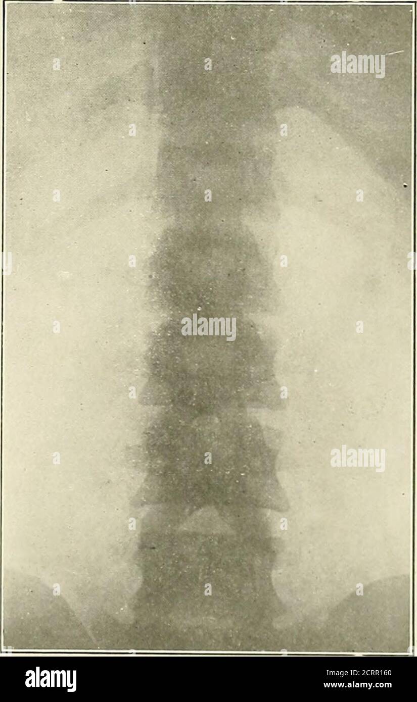 . The principles and practice of roentgenological technique . Fig. 236 ...