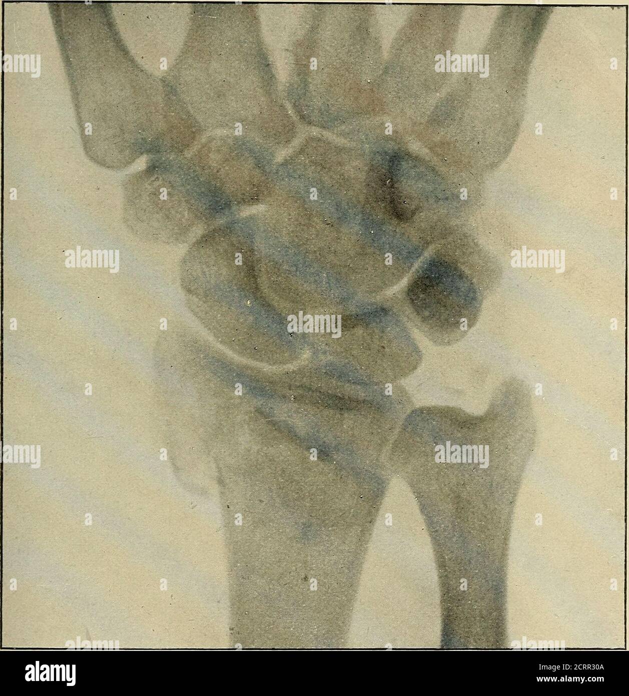 Schwanken hi-res stock photography and images - Alamy