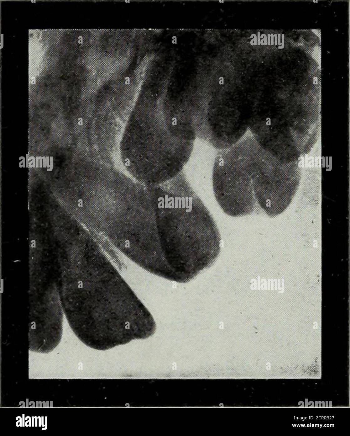 . Elementary and dental radiography . Fig. 296 Fig. 297 Fig. 296 ...