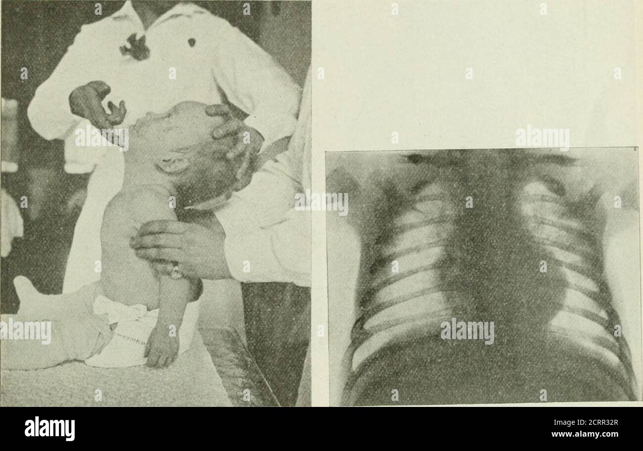 . Radium . infectious diseases, and convulsions. Thelatter consist of ...