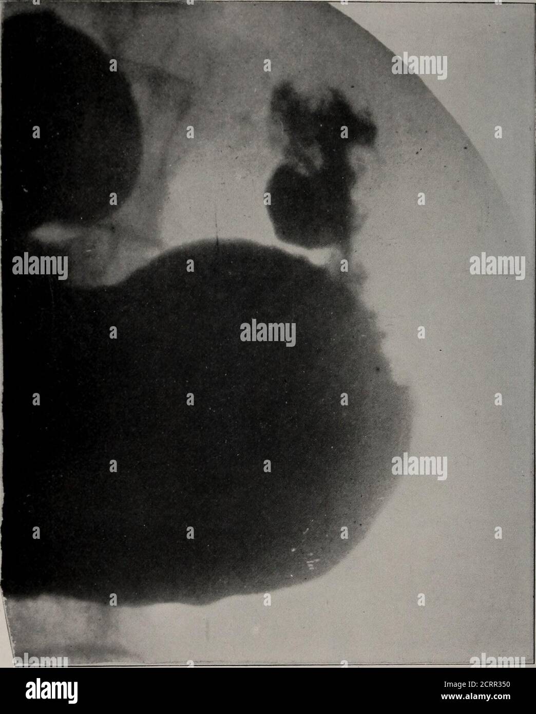 . American quarterly of roentgenology . Fig. 24. Clinical diagnosis ...