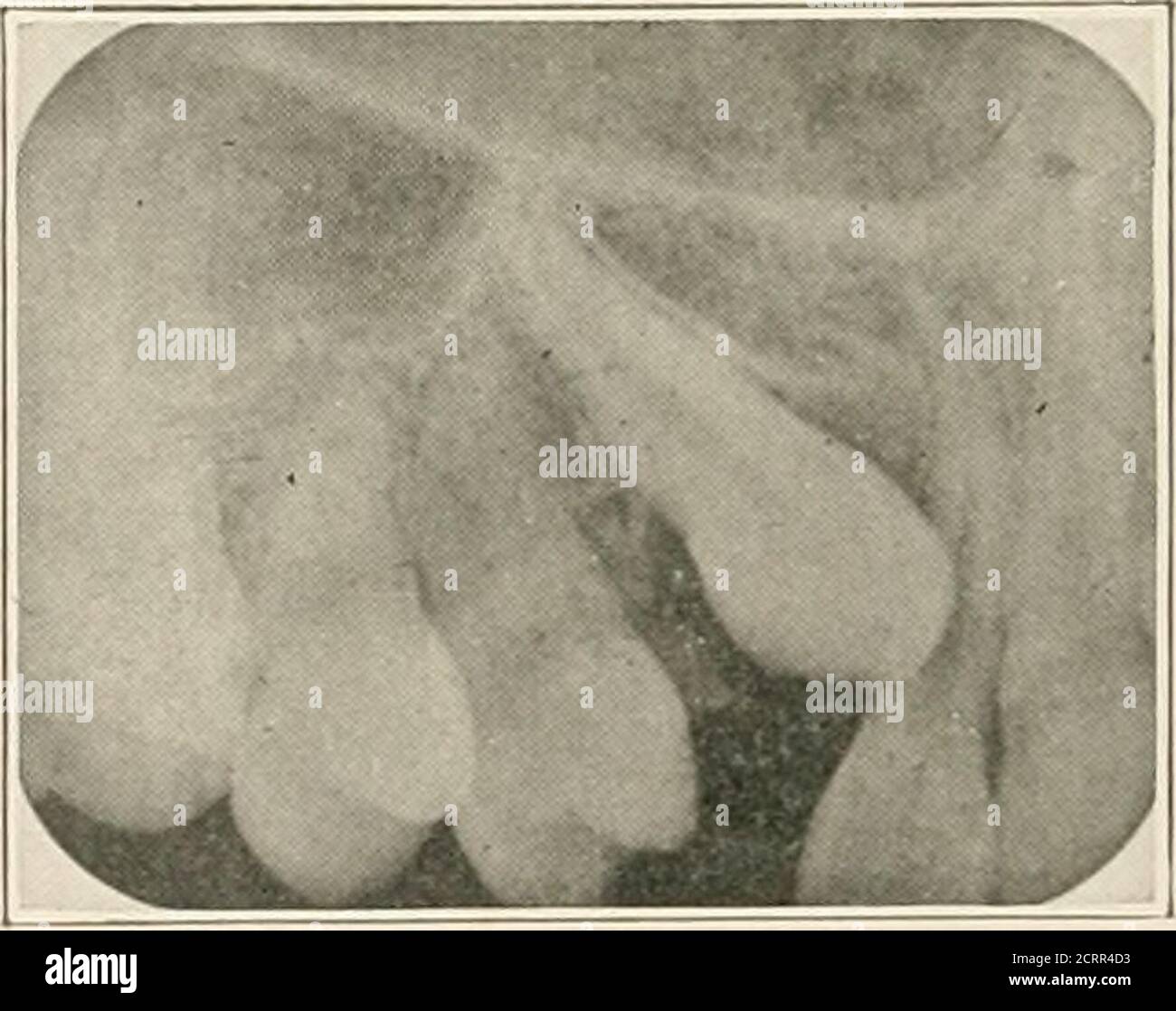 . Dental and oral radiography : a textbook for students and ...