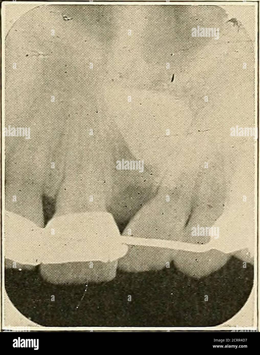 . Dental and oral radiography : a textbook for students and ...