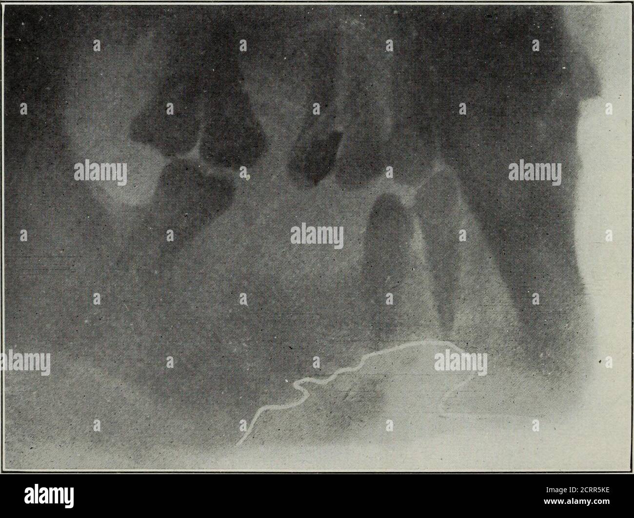 First Radiograph High Resolution Stock Photography and Images - Alamy