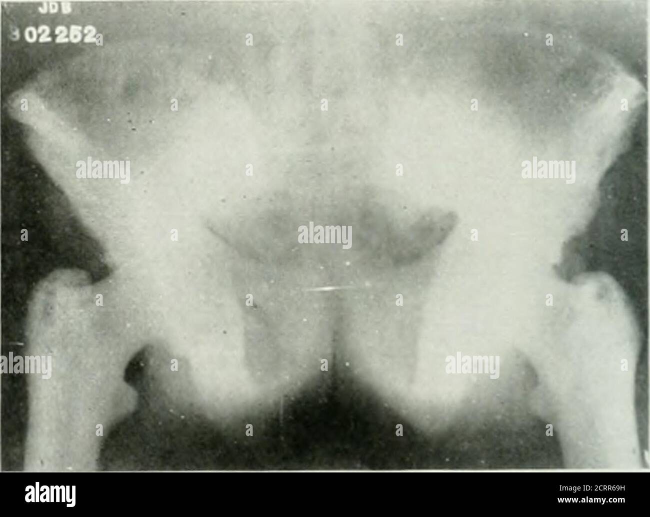 . The American journal of roentgenology, radium therapy and nuclear ...