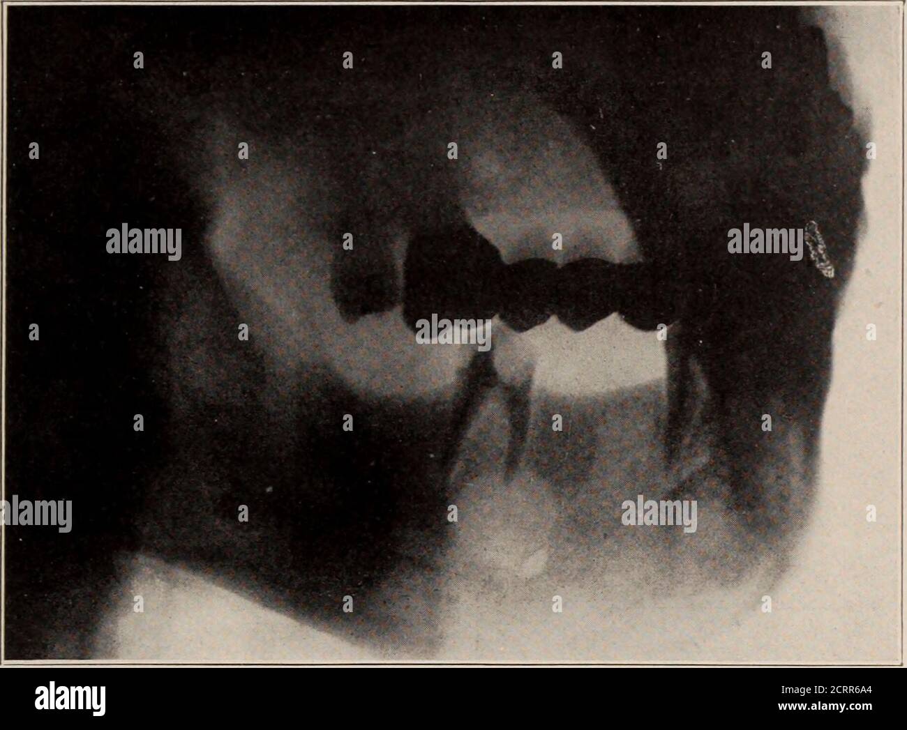 Dental and oral radiography : a text book for students and ...