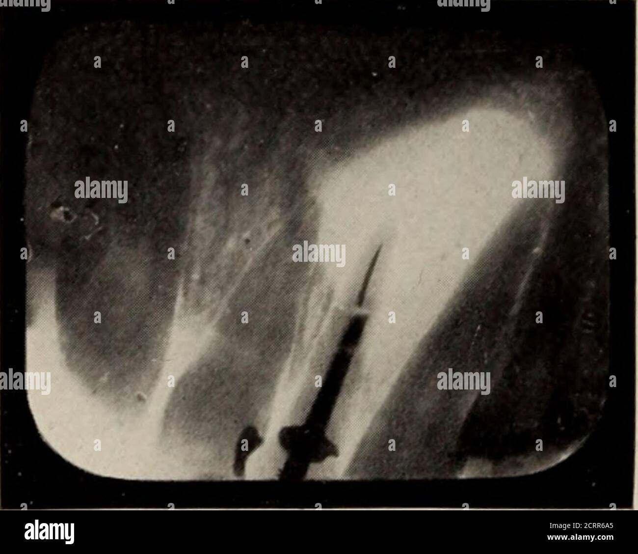 Dental and oral radiography : a text book for students and ...