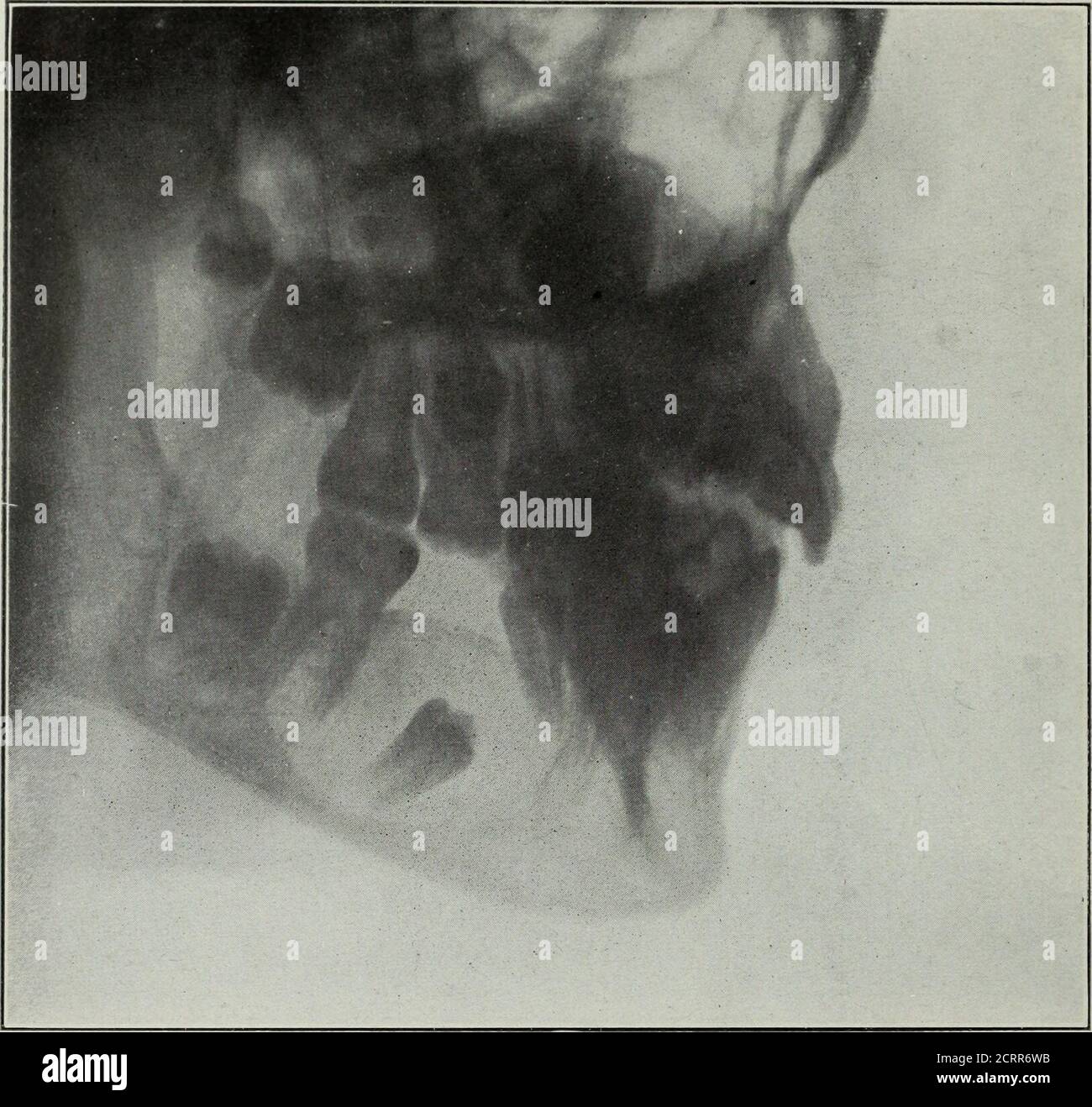 . Elementary and dental radiography . w in child nine years old. 1 he ...